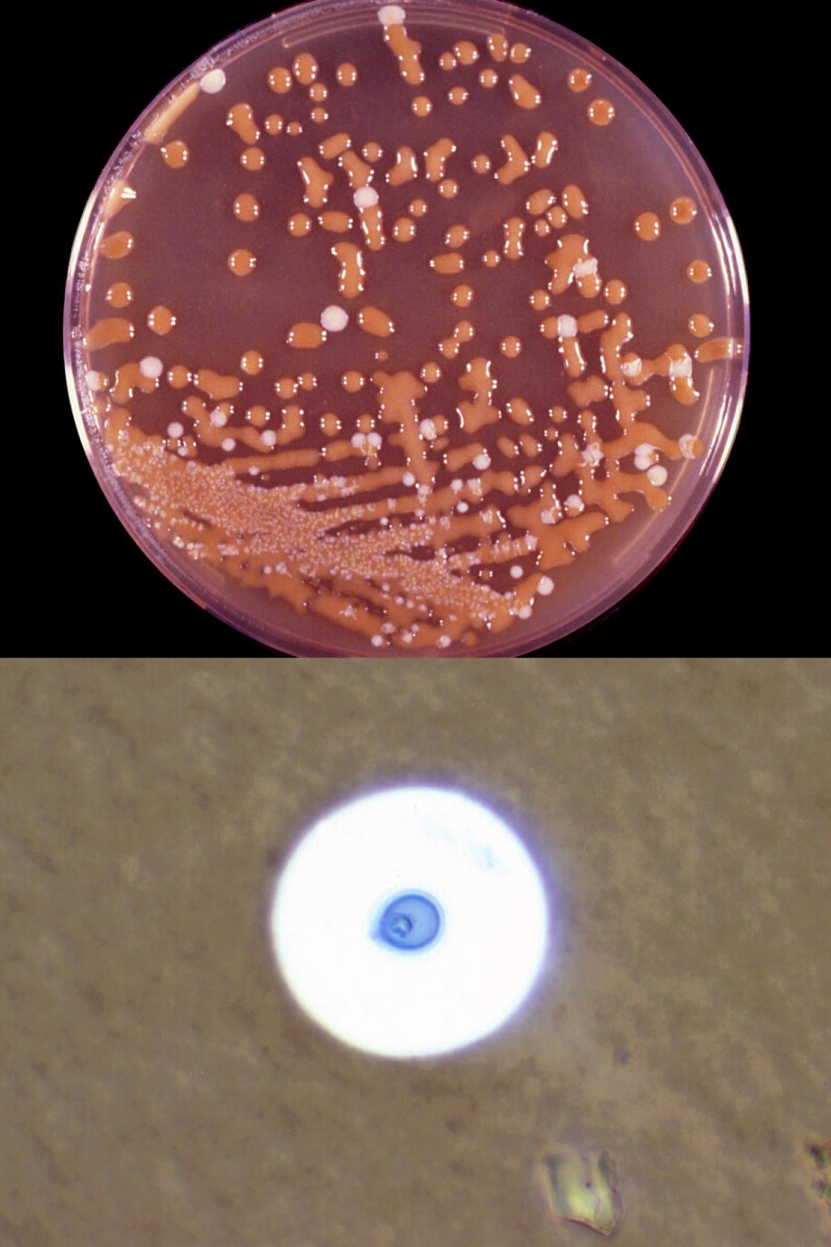 Cryptococcus Mycology University Of Adelaide