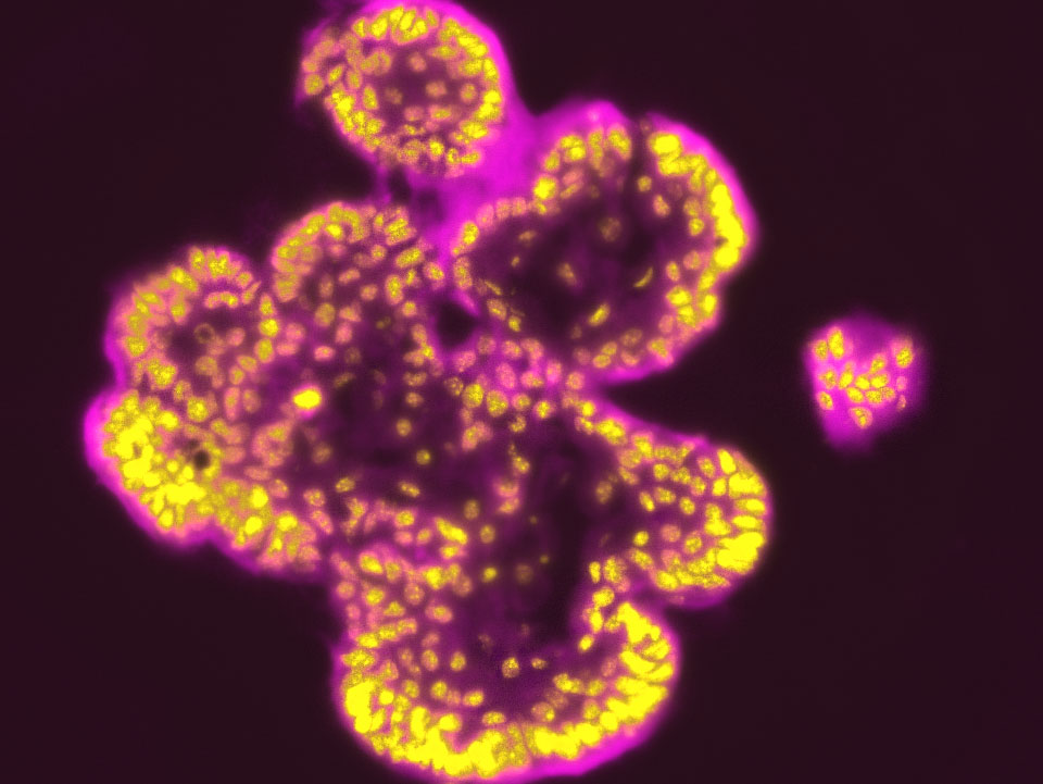 Unlocking the mysteries of prostate cancer | South Australian ...